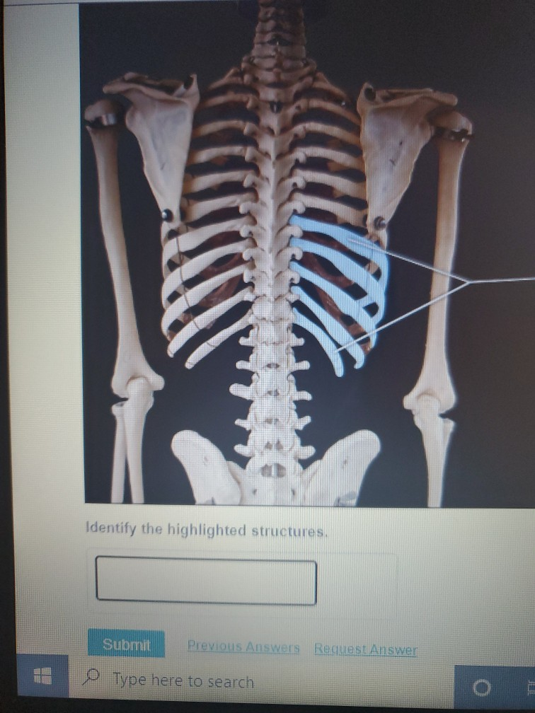Solved Identify the highlighted structures. Submit Previous | Chegg.com