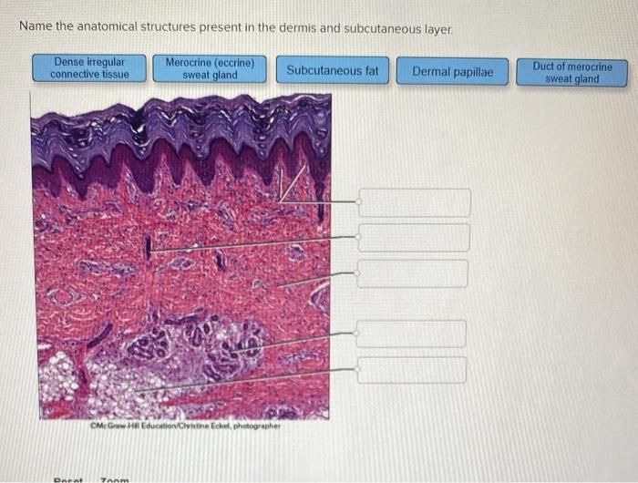 Name the anatomical structures present in the dermis | Chegg.com