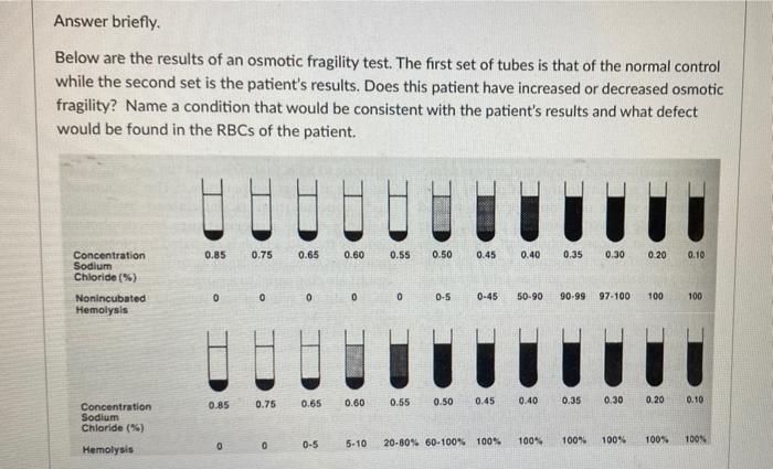 Solved Answer briefly. Below are the results of an osmotic | Chegg.com