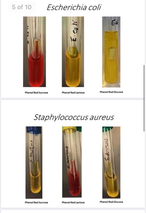 Solved Activity (1) Starch Hydrolysis Staphylococcus aureus | Chegg.com