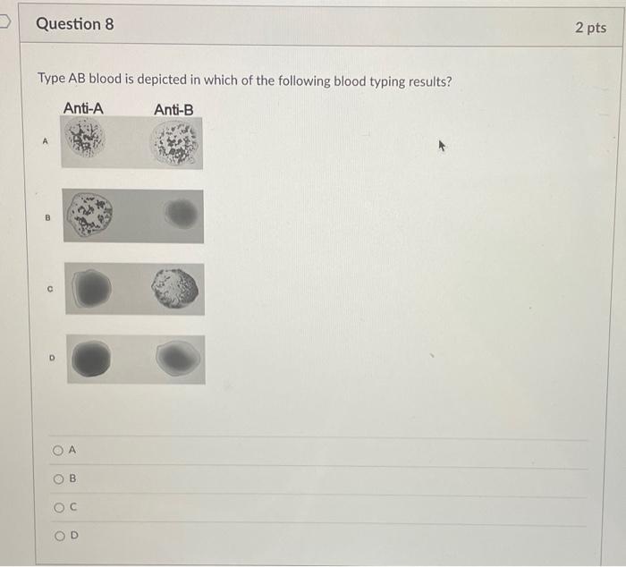 Solved Type AB blood is depicted in which of the following | Chegg.com