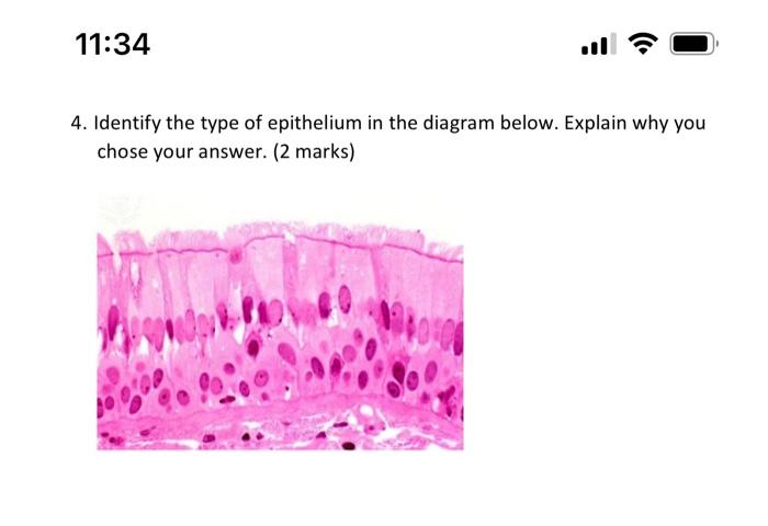Solved 11:34 4. Identify the type of epithelium in the | Chegg.com
