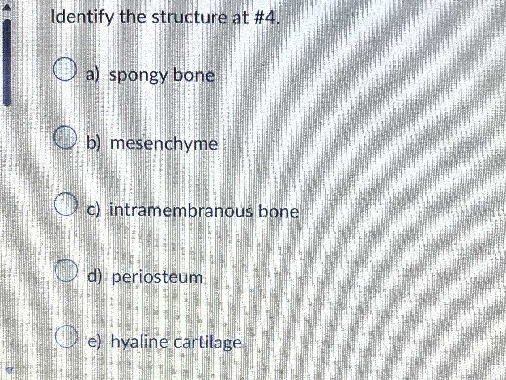 Solved Identify the structure at #4.a) ﻿spongy boneb) | Chegg.com