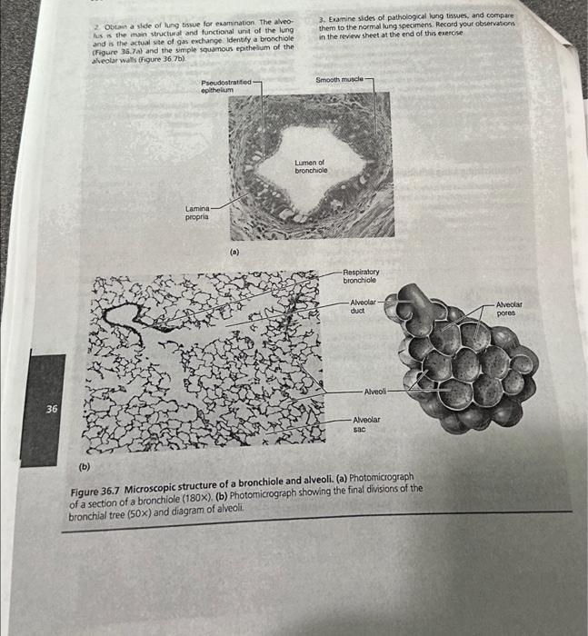 Solved Examining Prepared Slides of Trachea and Lung Tissue | Chegg.com