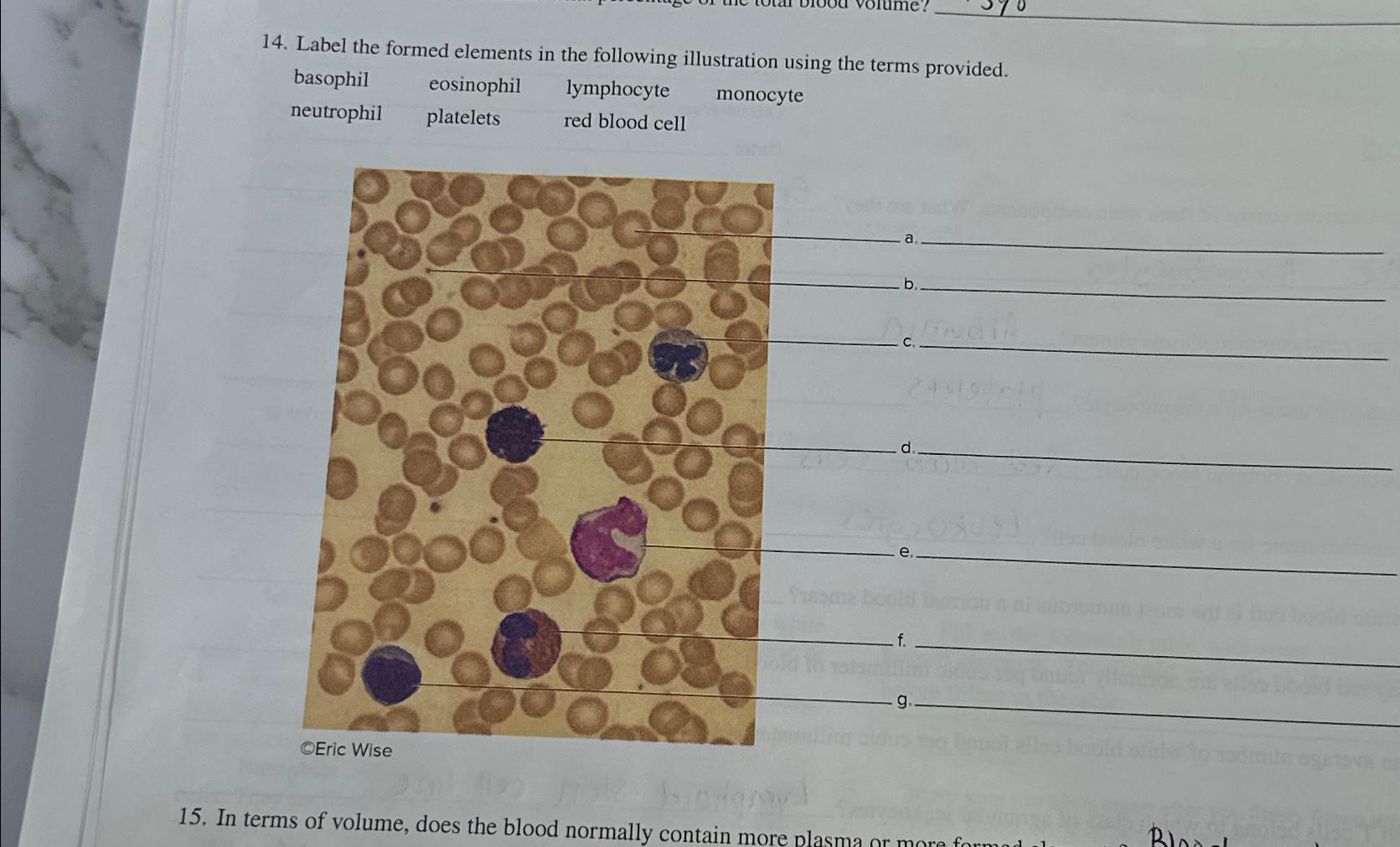 Solved Label the formed elements in the following | Chegg.com