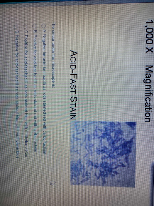 Solved 1,000 X Magnification Acid-FAST STAIN The smear under | Chegg.com