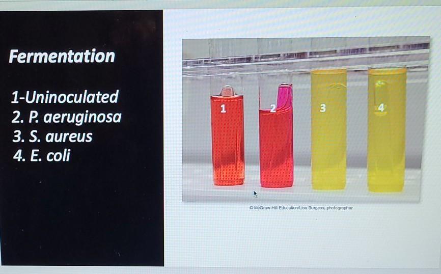 Solved Starch Agar-Looking at the results presentation | Chegg.com