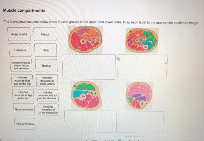 Solved Muscle compartments The transverse sections below | Chegg.com
