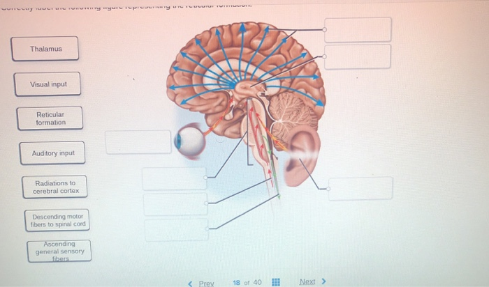 Solved 16 Thalamus Visual input Reticular formation Auditory | Chegg.com