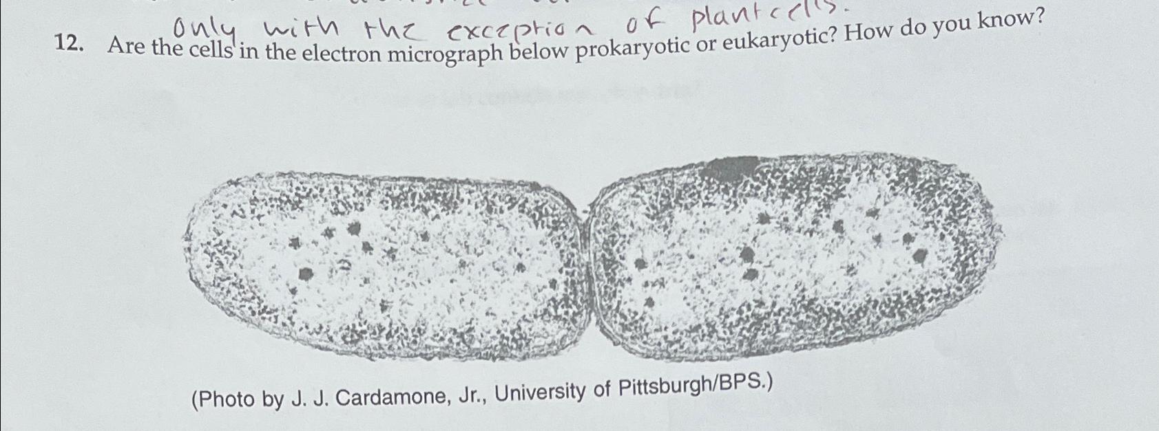 Solved Are the cells in with the exectron micrograph below | Chegg.com