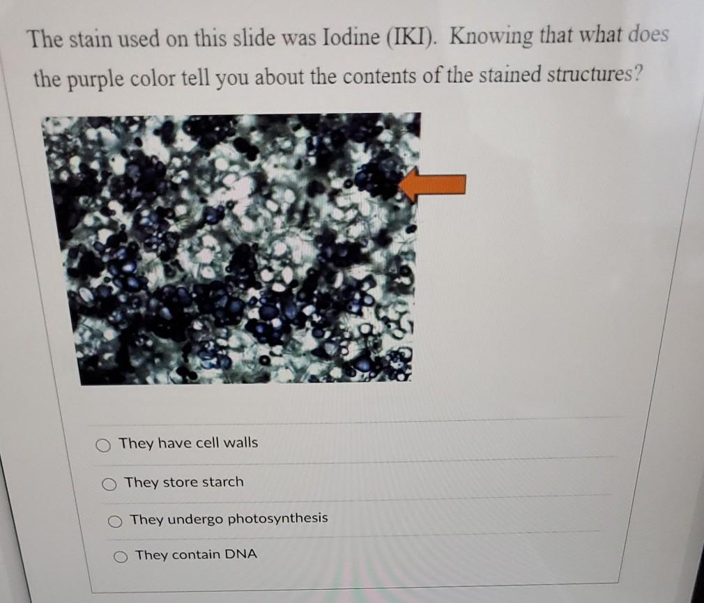Solved The stain used on this slide was Iodine (IKI). | Chegg.com