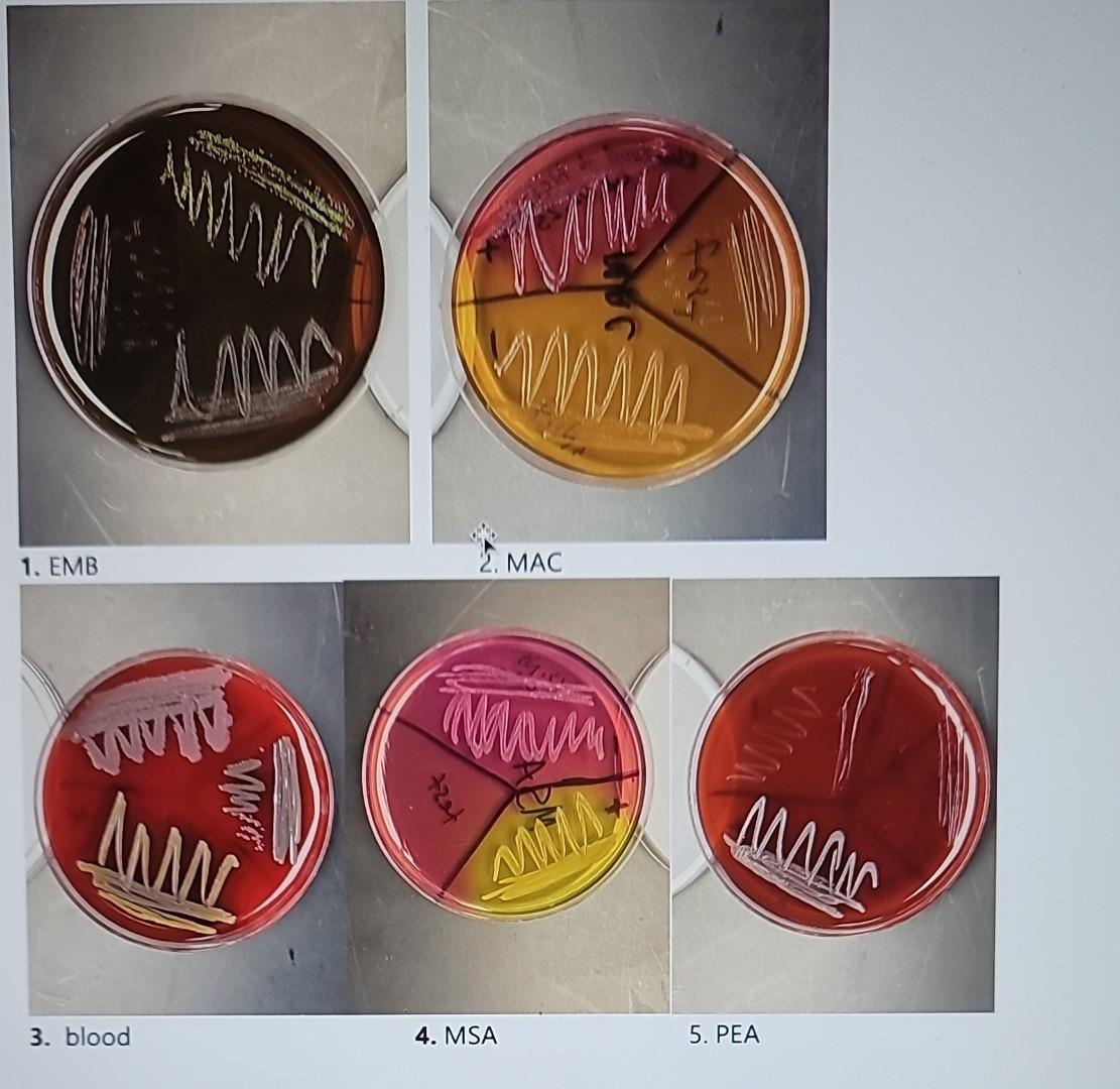 Solved 1. EMB 2. MAC 3. blood 4. MSA 5. PEAb) Results table | Chegg.com