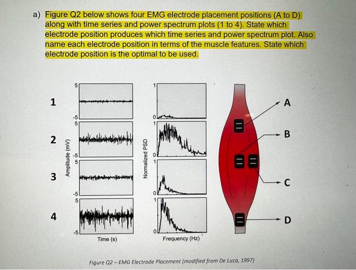 Solved Figure Q2 below shows four EMG electrode placement | Chegg.com