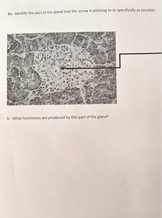 Solved 8a. Identify the part of the gland that the arrow is | Chegg.com