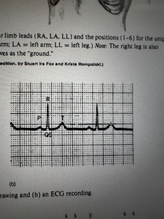 Solved r limb leads (RA, LA, LL) and the positions (1−6) for | Chegg.com