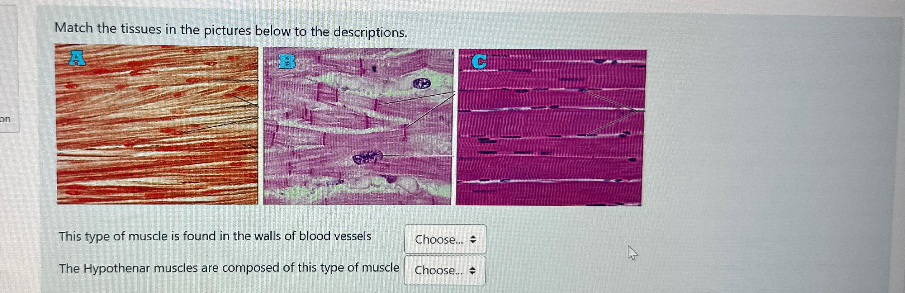 Solved Match the tissues in the pictures below to the | Chegg.com