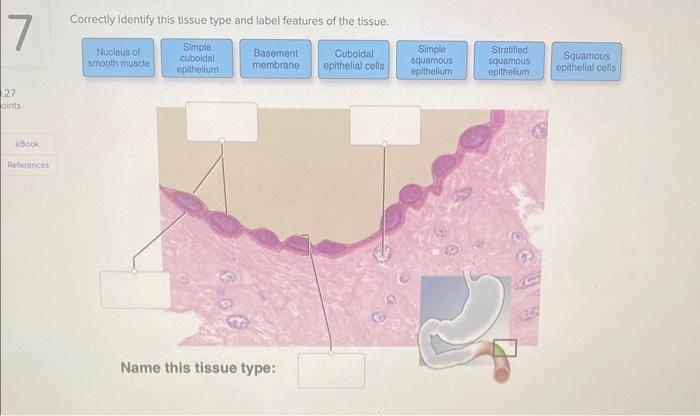 Solved Correctly identify this tissue type and label | Chegg.com Solved Correctly identify this tissue type and label | Chegg.com