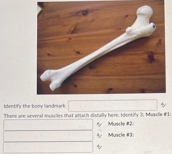 Solved 1. Identify the bony landmark of the knee, and what | Chegg.com