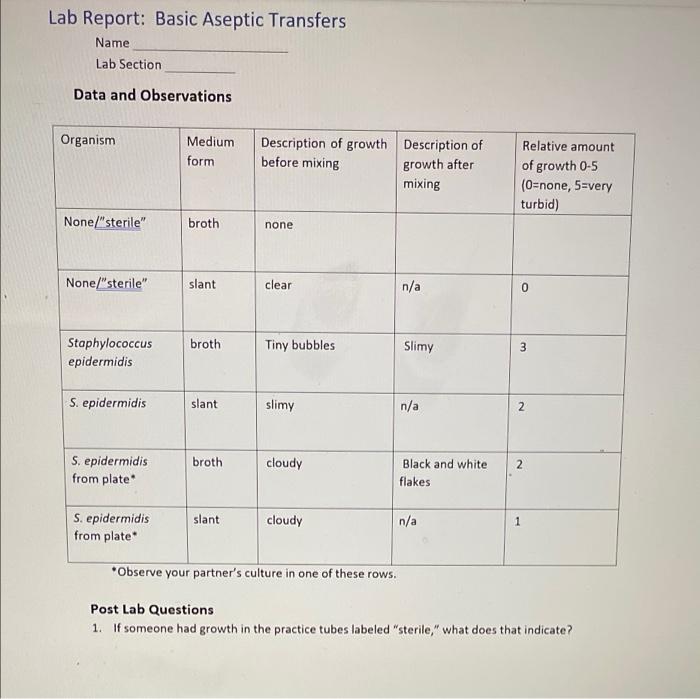 Solved Lab Report: Basic Aseptic Transfers Name Lab Section | Chegg.com