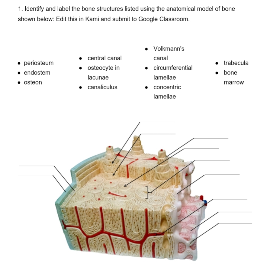 Solved Identify and label the bone structures listed using | Chegg.com