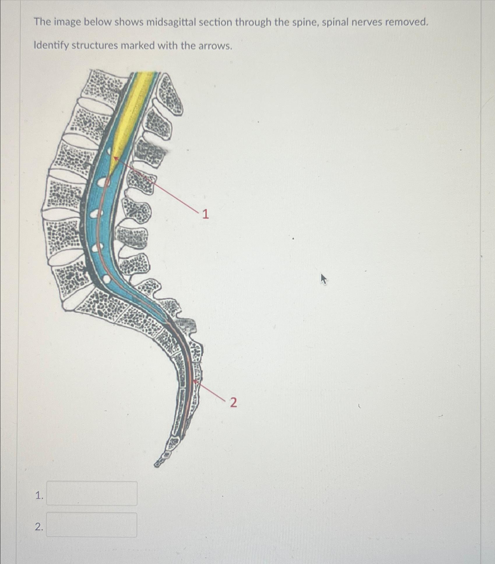 Solved The image below shows midsagittal section through the | Chegg.com