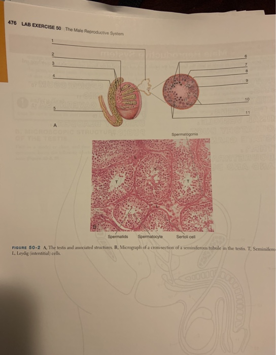 Solved 476 LAB EXERCISE 50 The Male Reproductive System 2 3 | Chegg.com