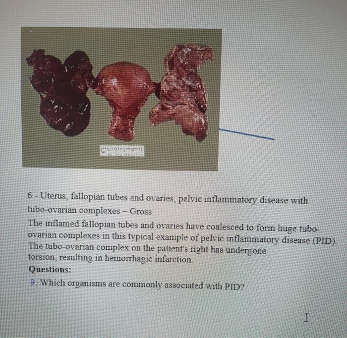 Solved On-line Case Study-Female Reproductive System A | Chegg.com