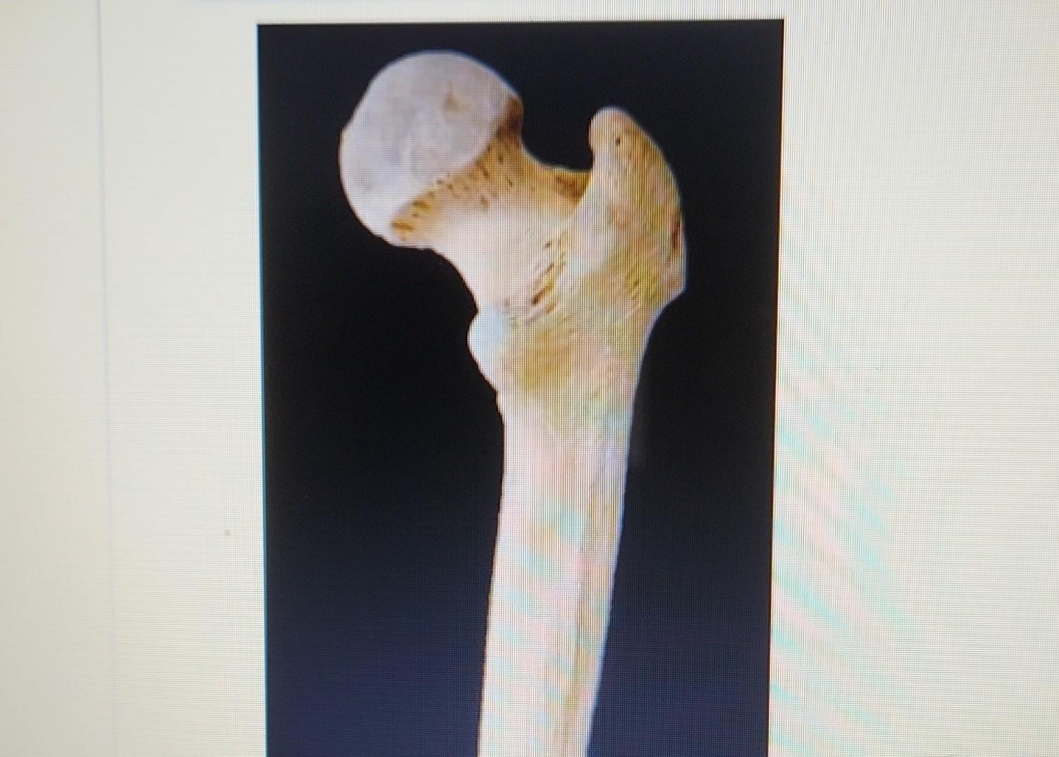 Solved Identify the highlighted structure. Identify the | Chegg.com Solved Identify the highlighted structure. Identify the | Chegg.com