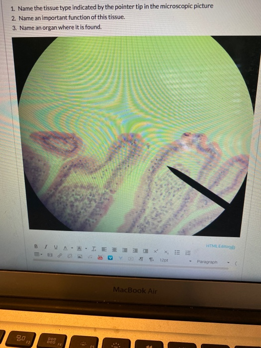 Solved 1. Name the tissue type indicated by the pointer tip | Chegg.com