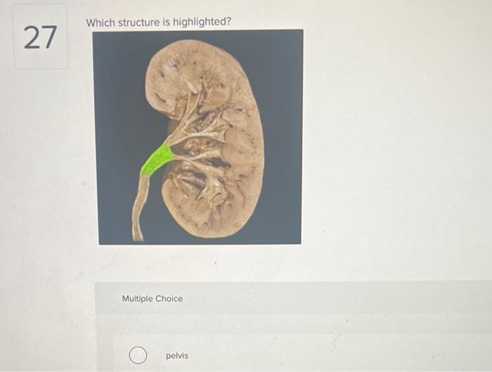 Solved Which structure is highlighted? Multiple Choice | Chegg.com