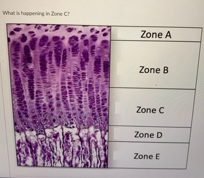 Solved What is happening in Zone C? Zone A Zone B Zone C | Chegg.com