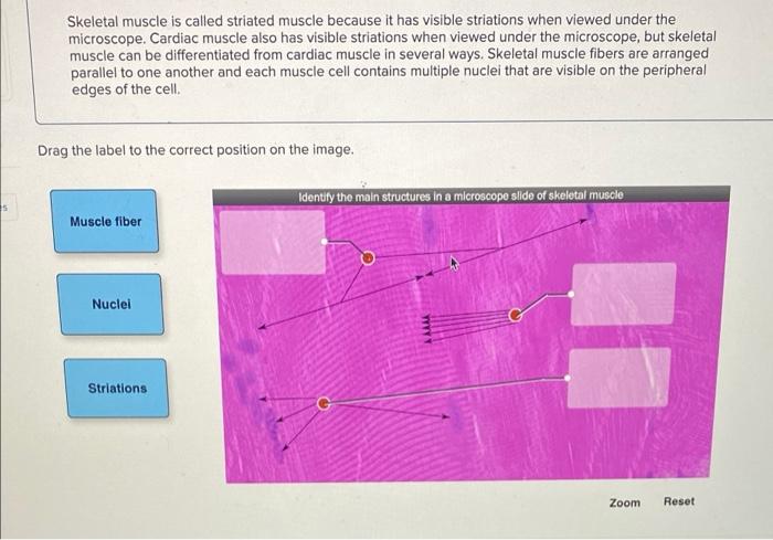 Solved Skeletal muscle is called striated muscle because it | Chegg.com