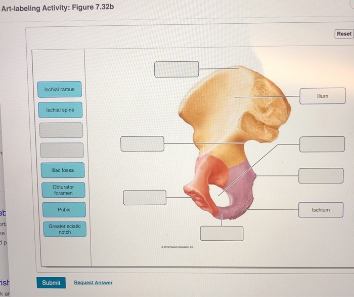 Solved Art-labeling Activity: Figure 7.32b Reset Ischial | Chegg.com