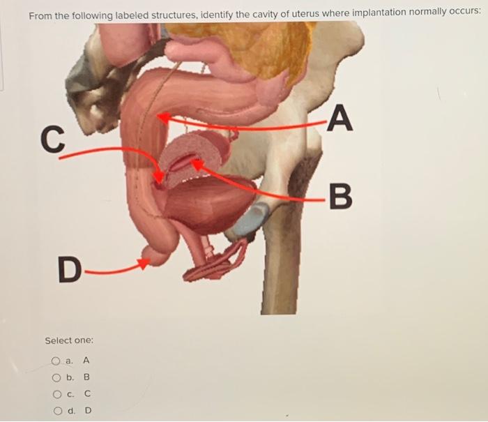 Solved From the following labeled structures, identify the | Chegg.com