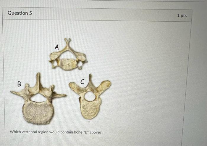 Solved Which vertebral region would contain bone "B" above? | Chegg.com