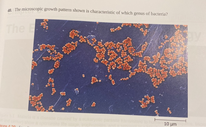 Solved 48. The microscopic growth pattern shown is | Chegg.com