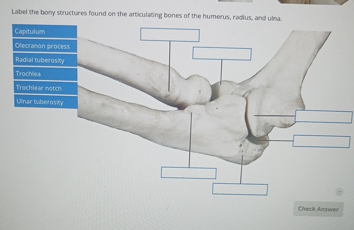 Solved Label the bony structures found on the articulating | Chegg.com