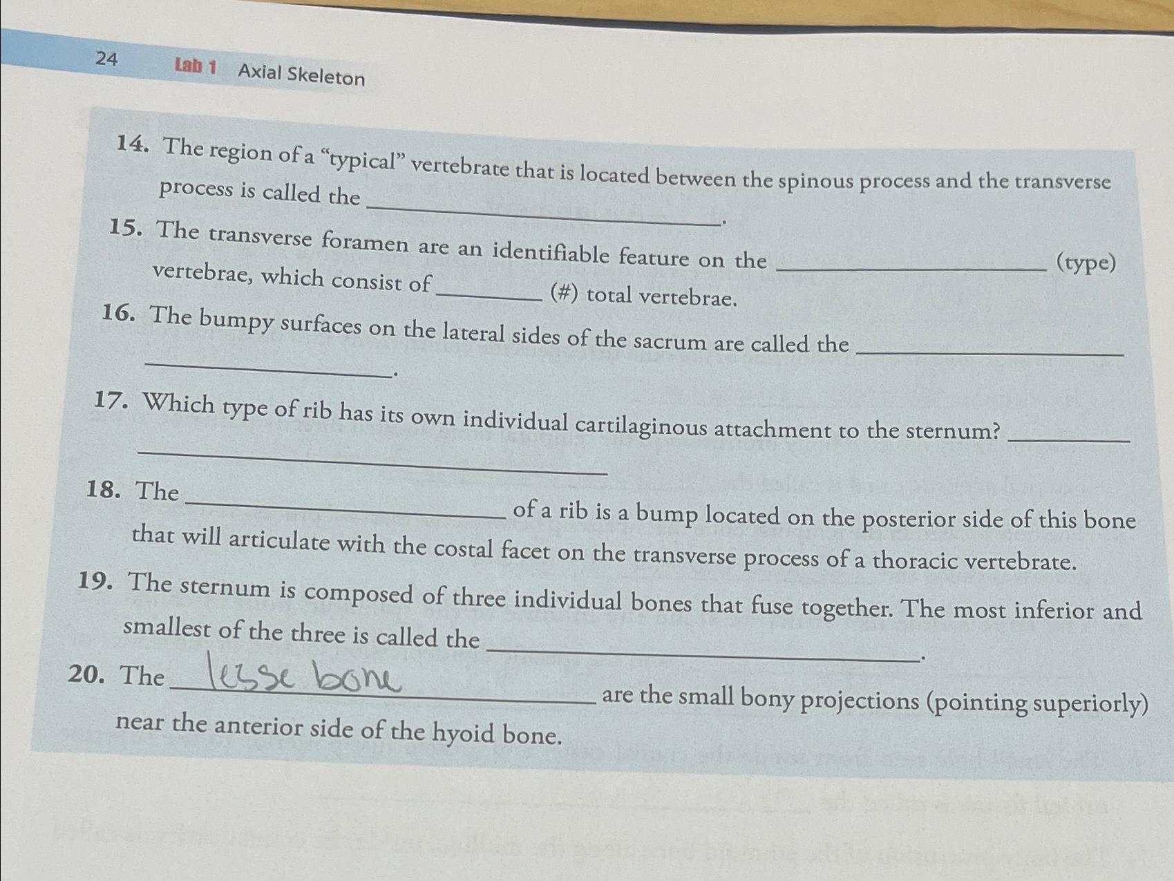 Solved 24 ﻿Lah 1 ﻿Axial Skeleton14. ﻿The region of a | Chegg.com
