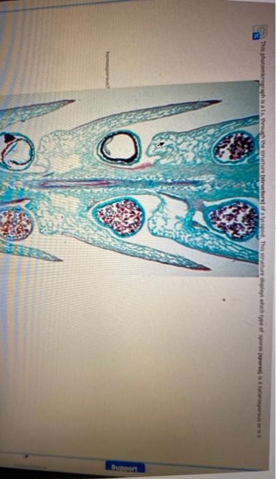 Solved "This photomicrograph is a i.s theough the structure | Chegg.com