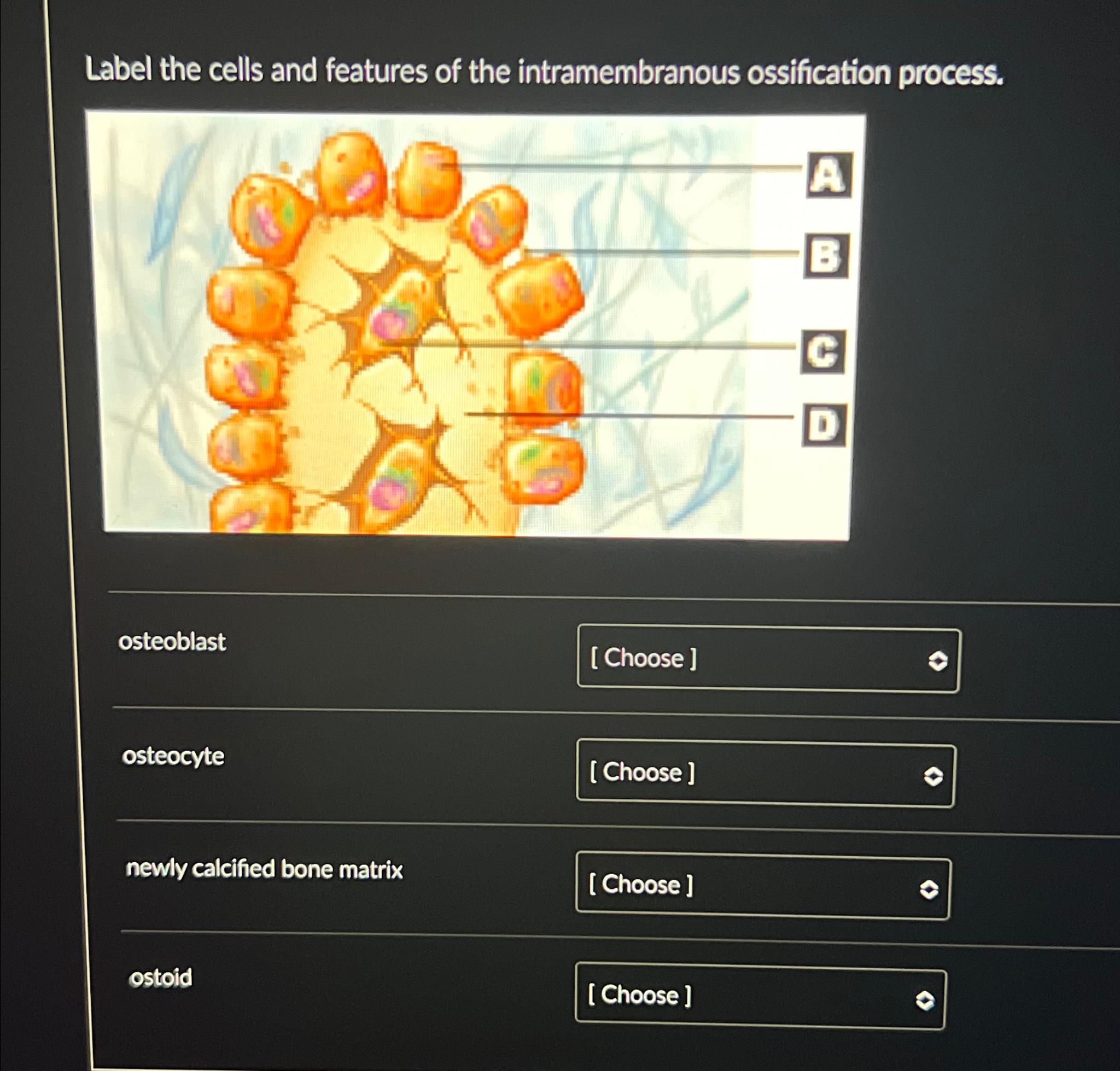Solved Label the cells and features of the intramembranous | Chegg.com