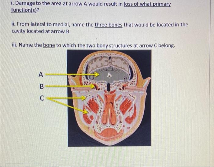 Solved i. Damage to the area at arrow A would result in loss | Chegg.com