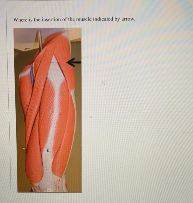 Solved Identify the muscle indicated by arrow. Where is the | Chegg.com