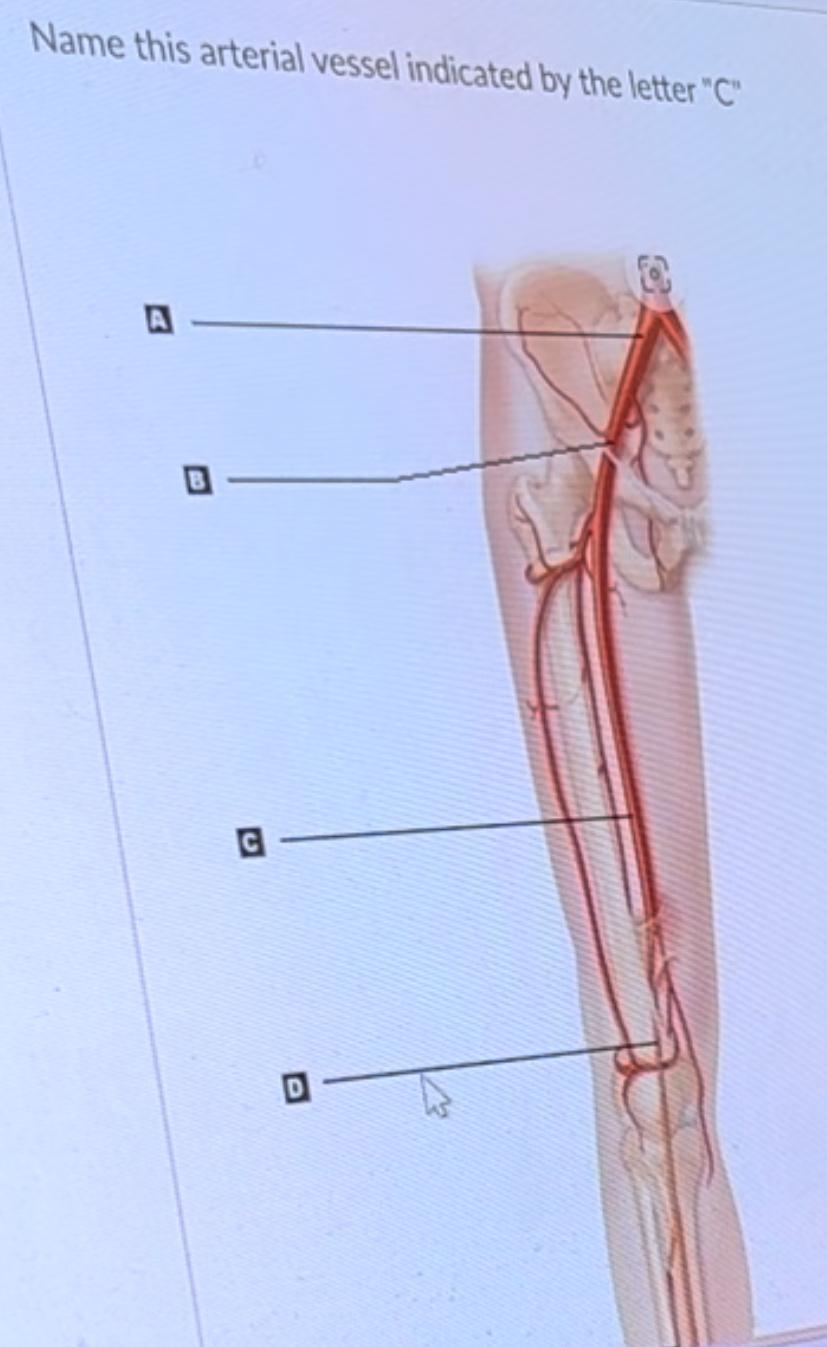 Solved Name this arterial vessel indicated by the letter | Chegg.com