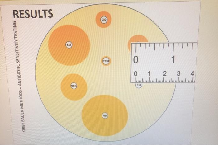 Solved Results: Table 1. Zone Size Interpretation Chart and | Chegg.com