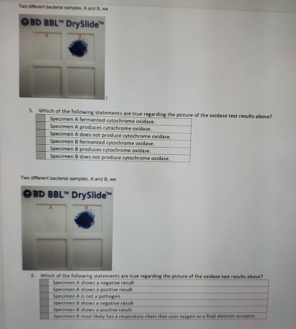 Solved Two different bacterial samples A and B. we OBD | Chegg.com