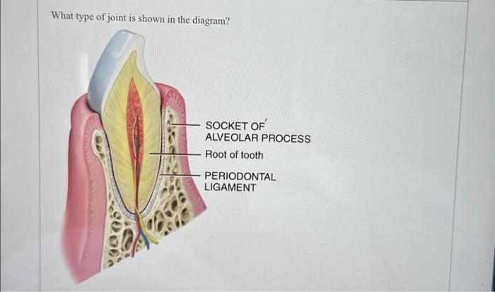 Solved What type of joint is shown in the diagram? SOCKET OF | Chegg.com