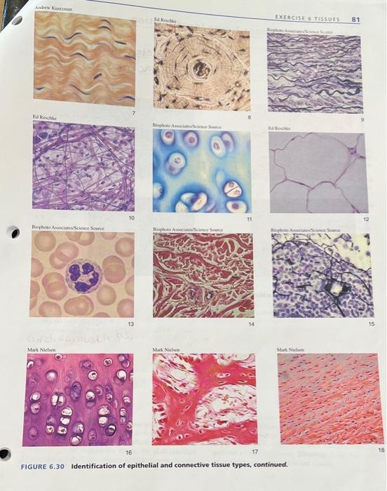 Solved 80 EXERCISE 6 TISTUES E. Epithelial and Connective | Chegg.com