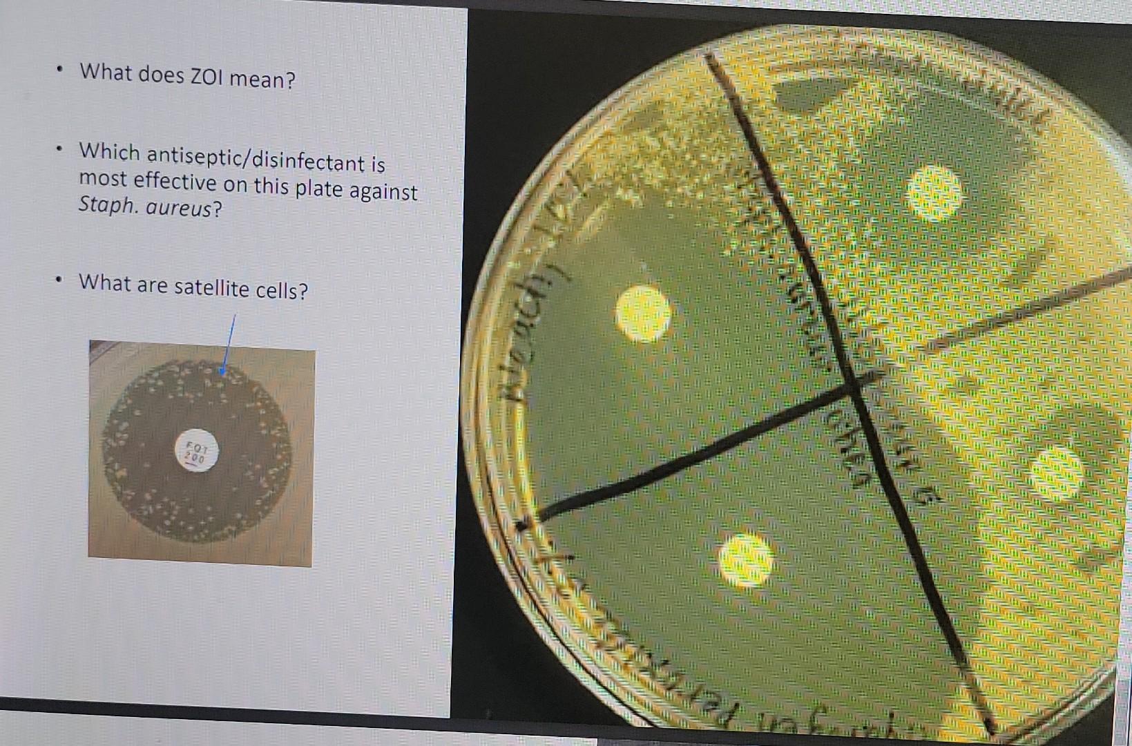 Solved What does Zol mean? Which antiseptic/disinfectant is | Chegg.com