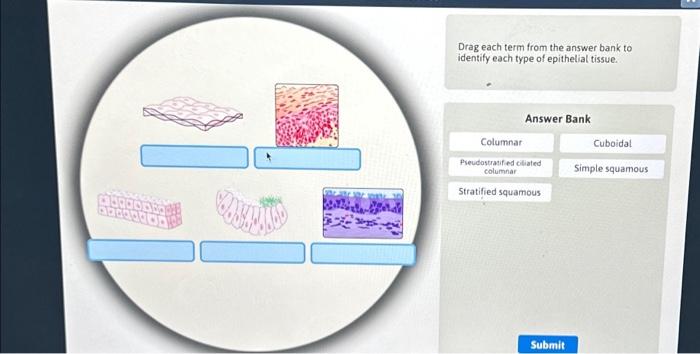 Drag each term from the answer bank to identify each | Chegg.com