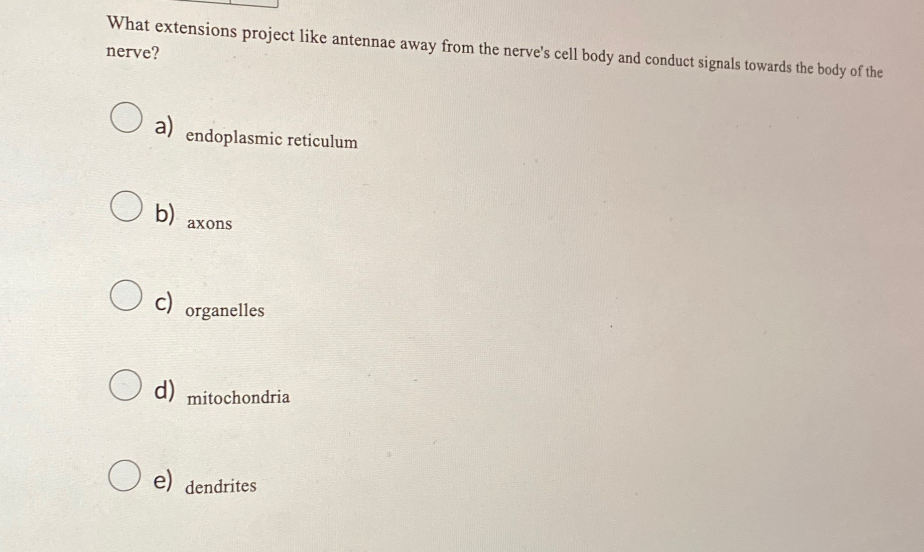 Solved What extensions project like antennae away from the | Chegg.com